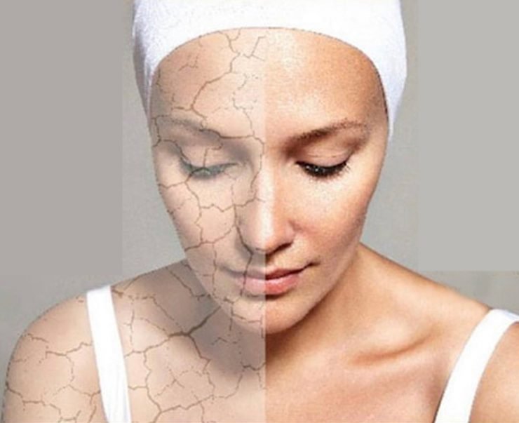 DIY Test To See If Your Skin Is Dry or Just Dehydrated & Here's How to ...